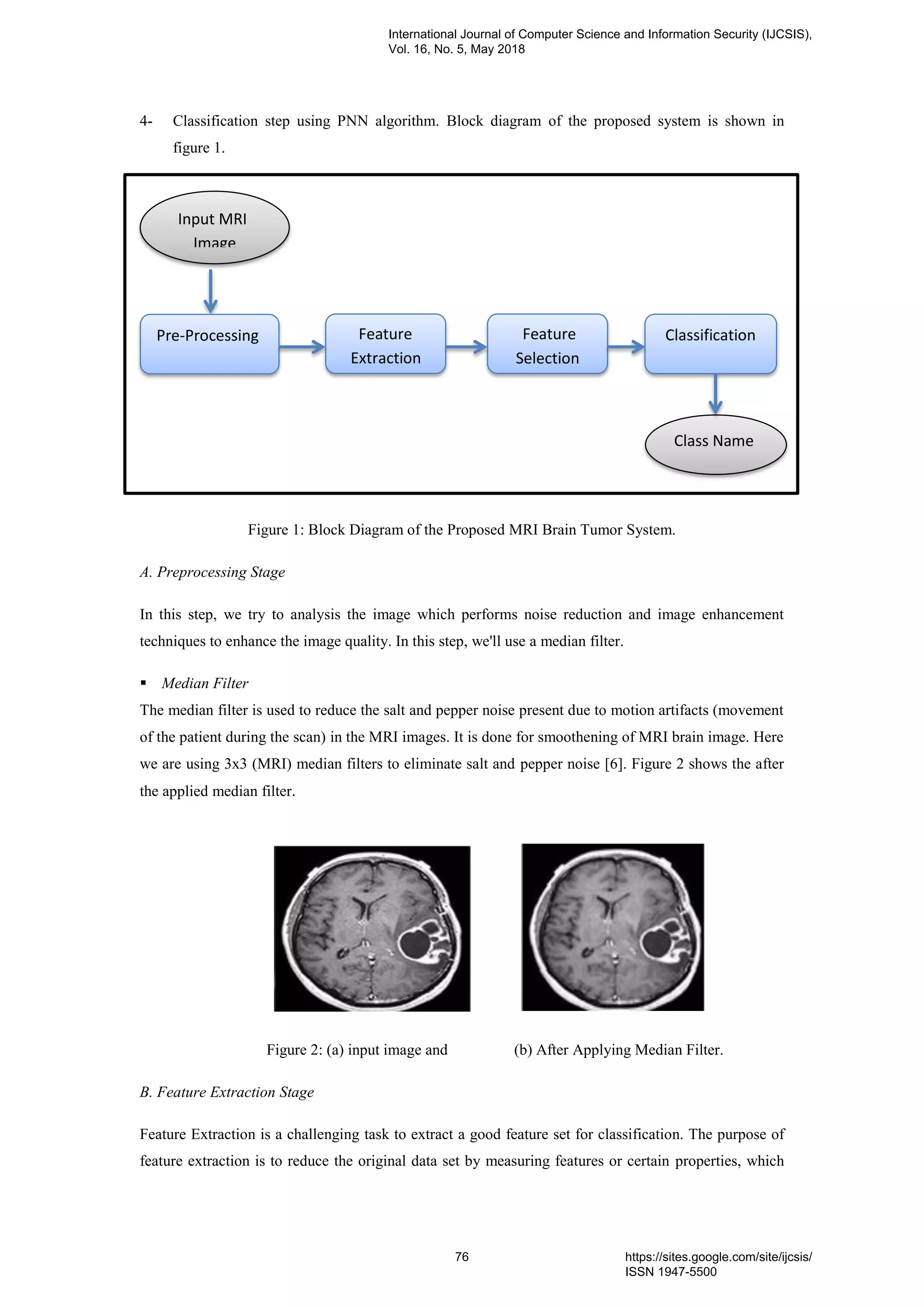 A Hybrid Approach For Classification Of Mri Brain Tumors Using Genetic Algorithm K Nearest