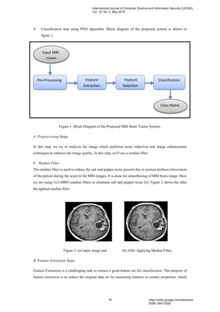 A Hybrid Approach for Classification of MRI Brain Tumors Using Genetic ...