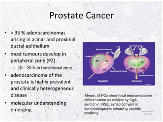 Rare Solid Cancers: An Introduction - Slide 10 - V. Kataja - Rare ...