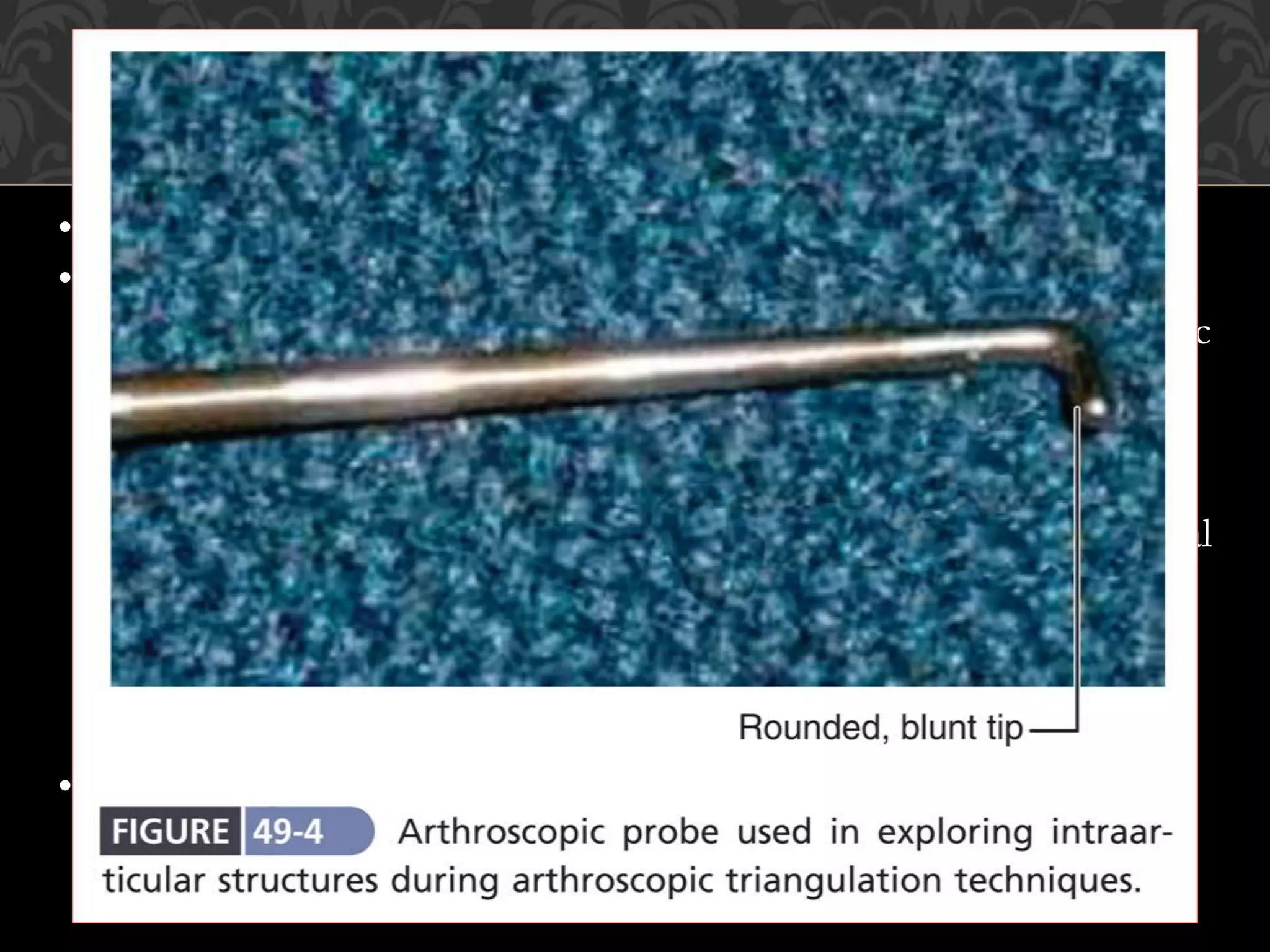 10 seminar arthroscopy of knee and meniscectomy | PPTX