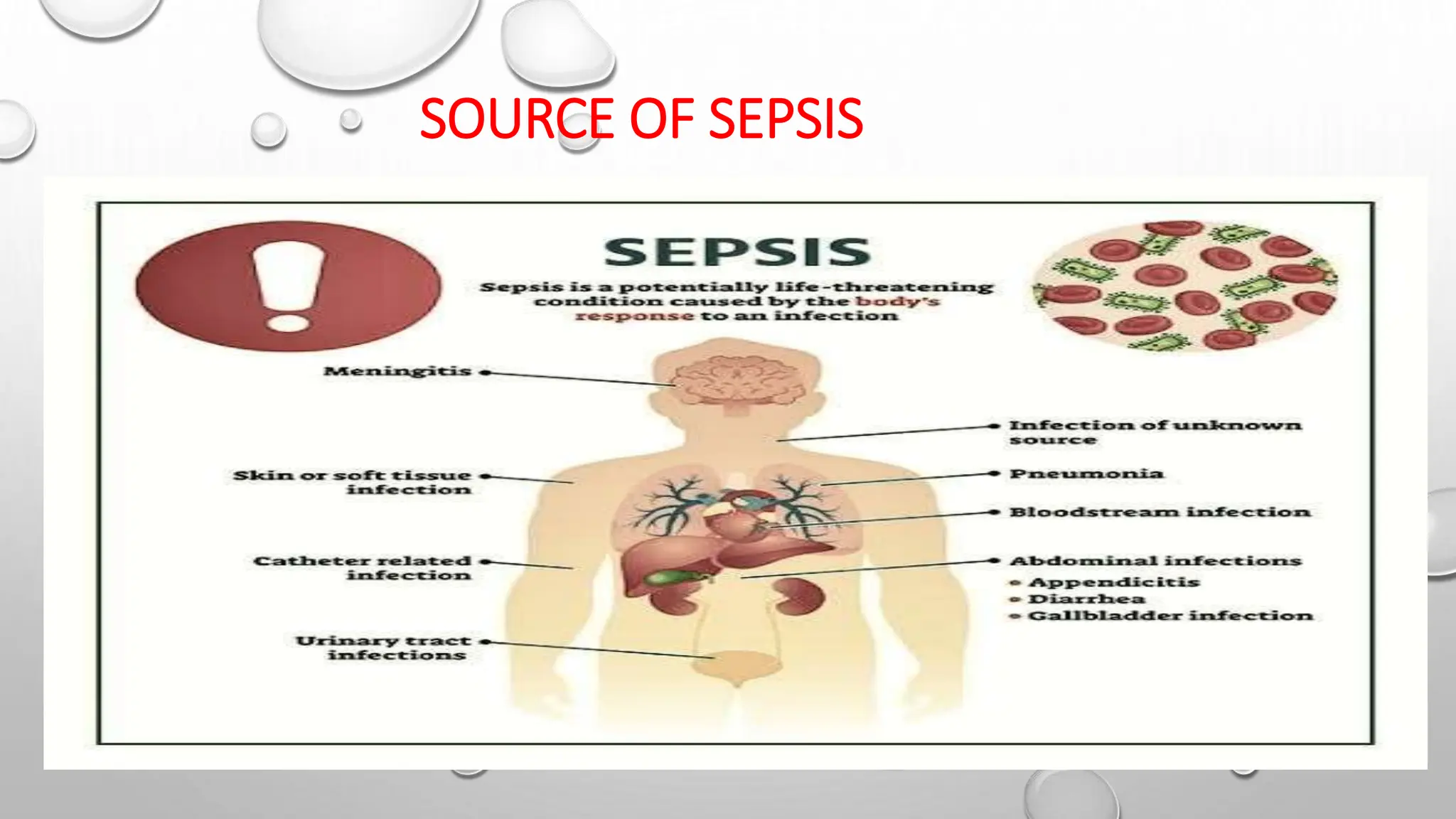 Blood culture role in sepsis and it's management | PPTX