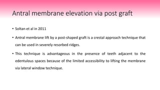 10 SINUS LIFT PROCEDURES seminar 10.pptx