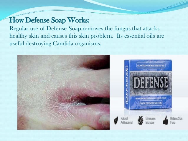 Defeat 10 Skin Diseases In Sports With Antibacterial Soap