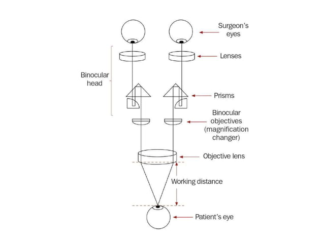 10 slit lamp and operating microscope | PPTX | Eye and Vision ...