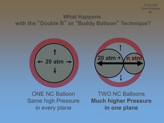 10 technical Dangoisse aimradial20170922 Buddy ballooning | PPT