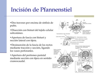 10 Tecnica quirurgica de la cesarea.pdf