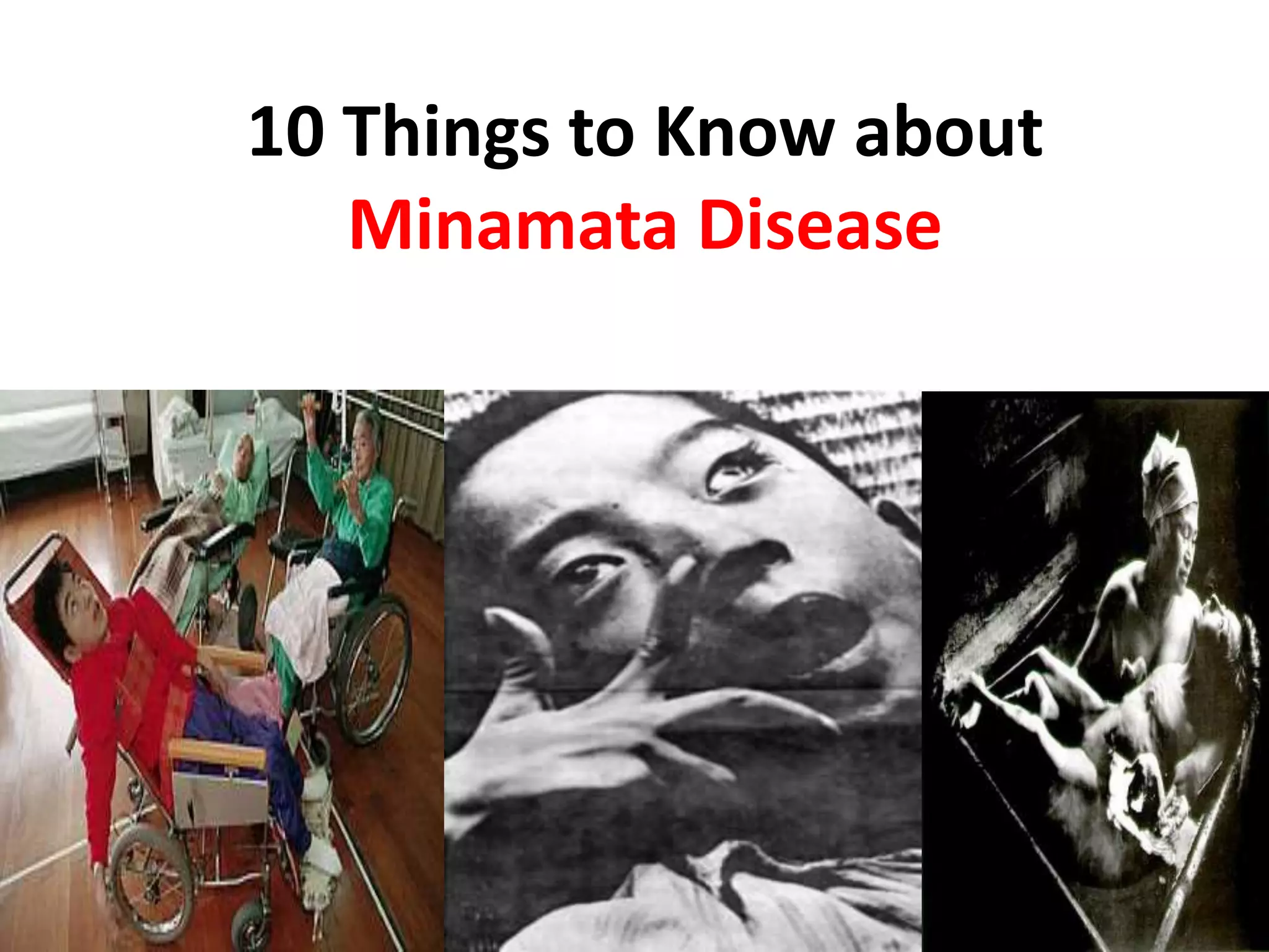 Minamata Disease.pptx