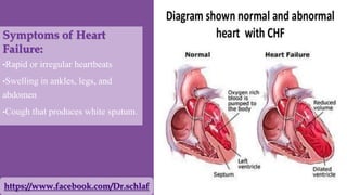 Heart Disease Symptoms & Types | PPT