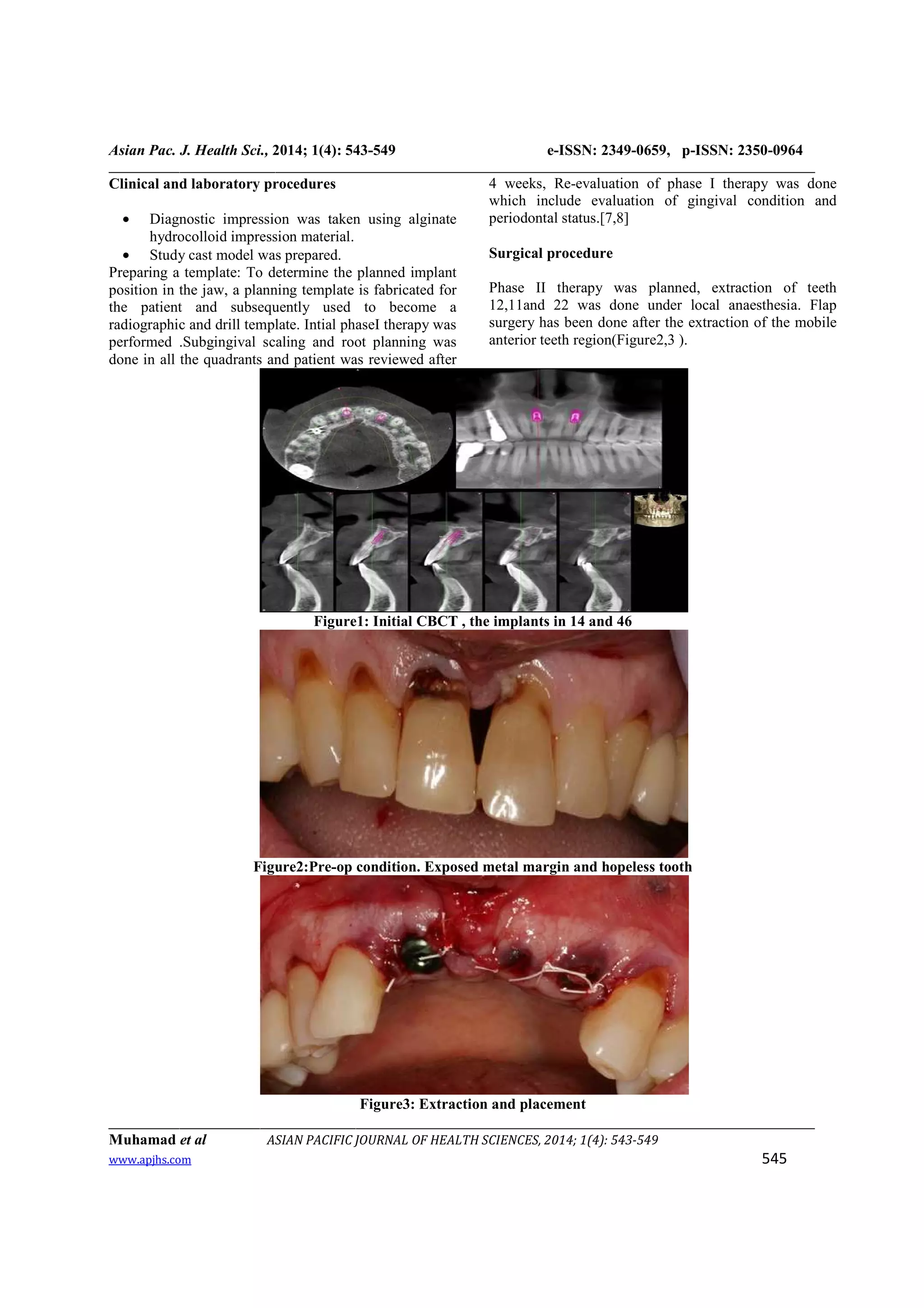 tooth extraction, immediate implant placement a case report | PDF