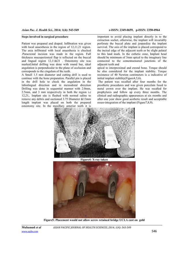 tooth extraction, immediate implant placement a case report | PDF