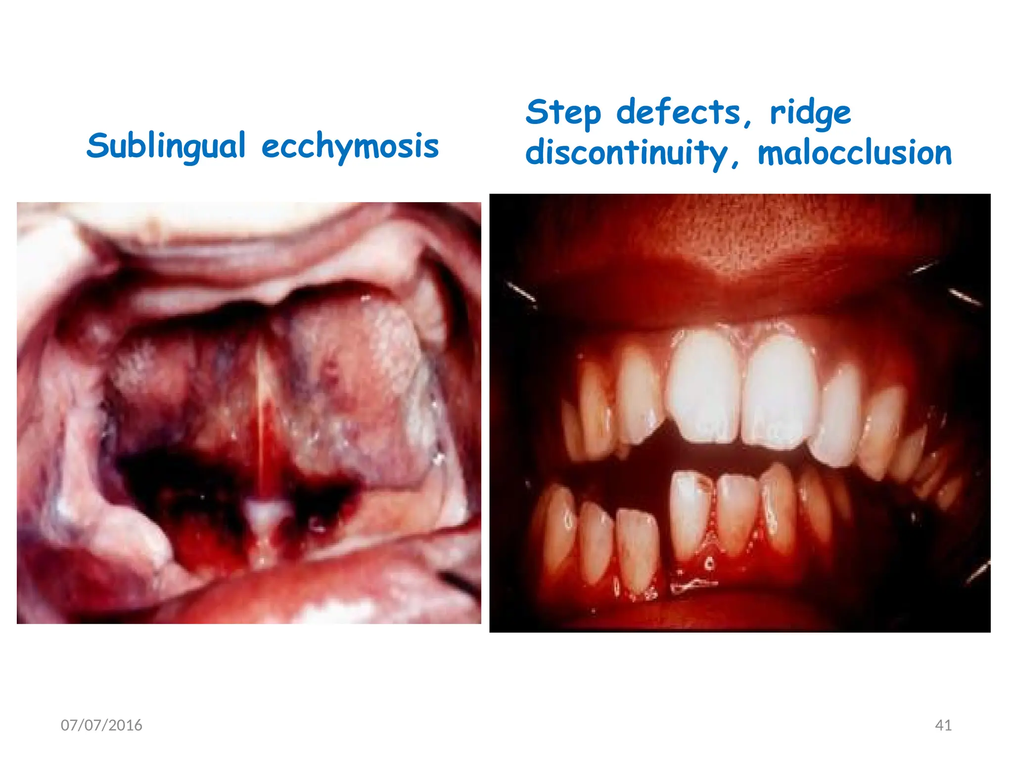 10)Trauma of tooth, soft tissue and jaws.pptx