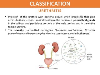 Urinary Tract Infections | PPTX