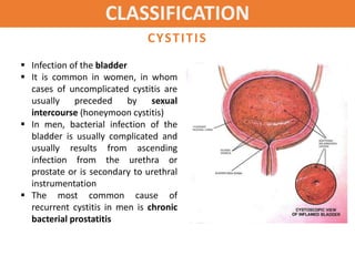 Urinary Tract Infections | PPTX