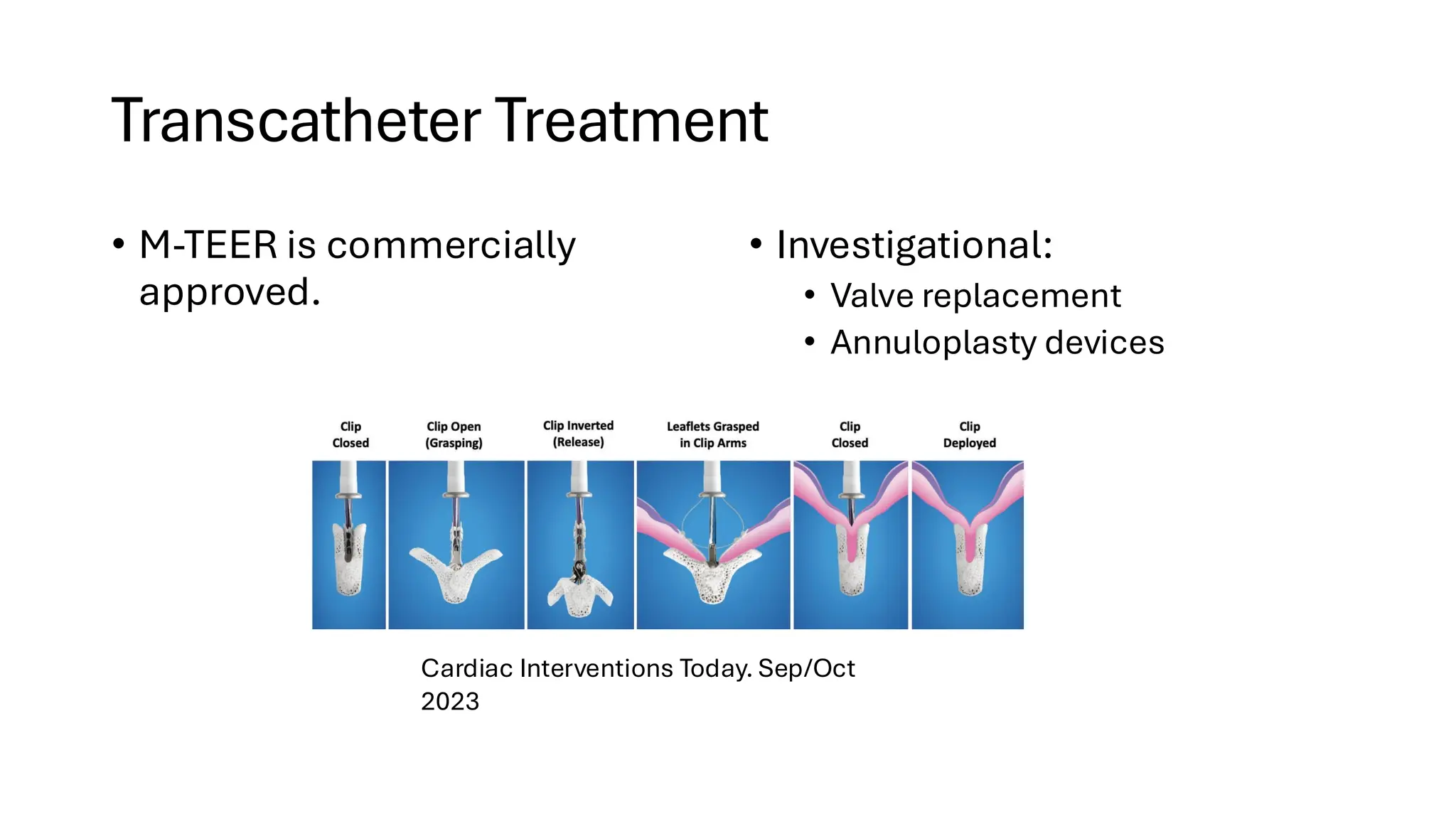 Ventricular Functional Mitral Regurgitation Management | PDF
