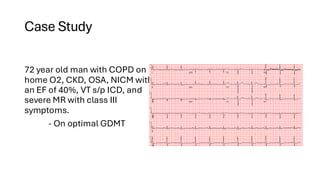 Ventricular Functional Mitral Regurgitation Management | PDF