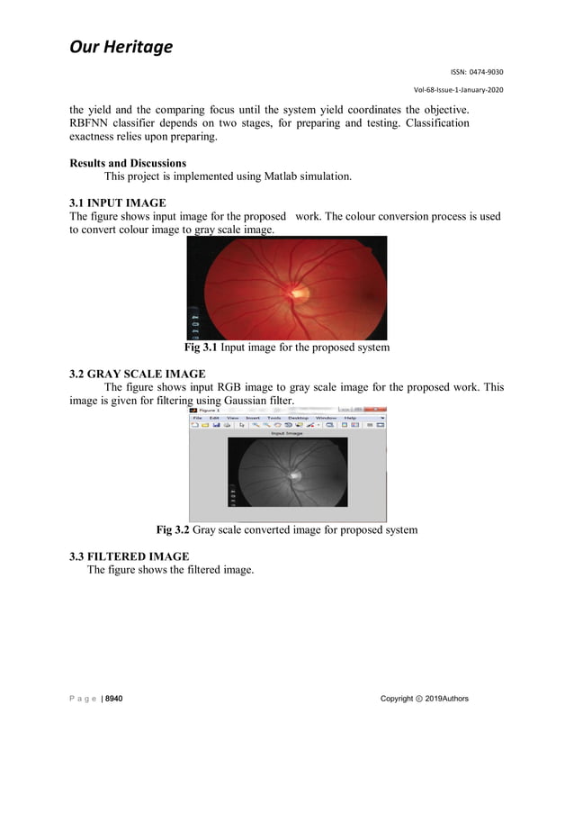 Deep Learning Radial Basis Function Neural Networks Based Automatic Detection Of Diabetic