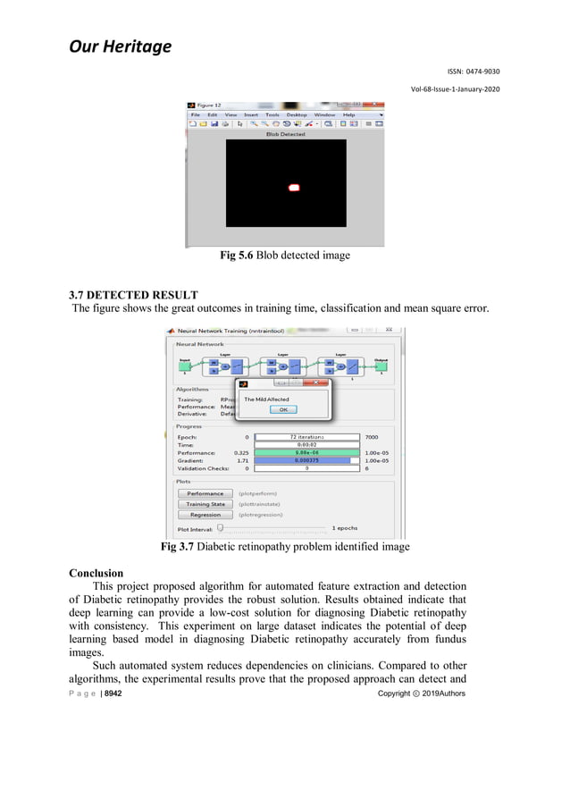 Deep Learning Radial Basis Function Neural Networks Based Automatic Detection Of Diabetic