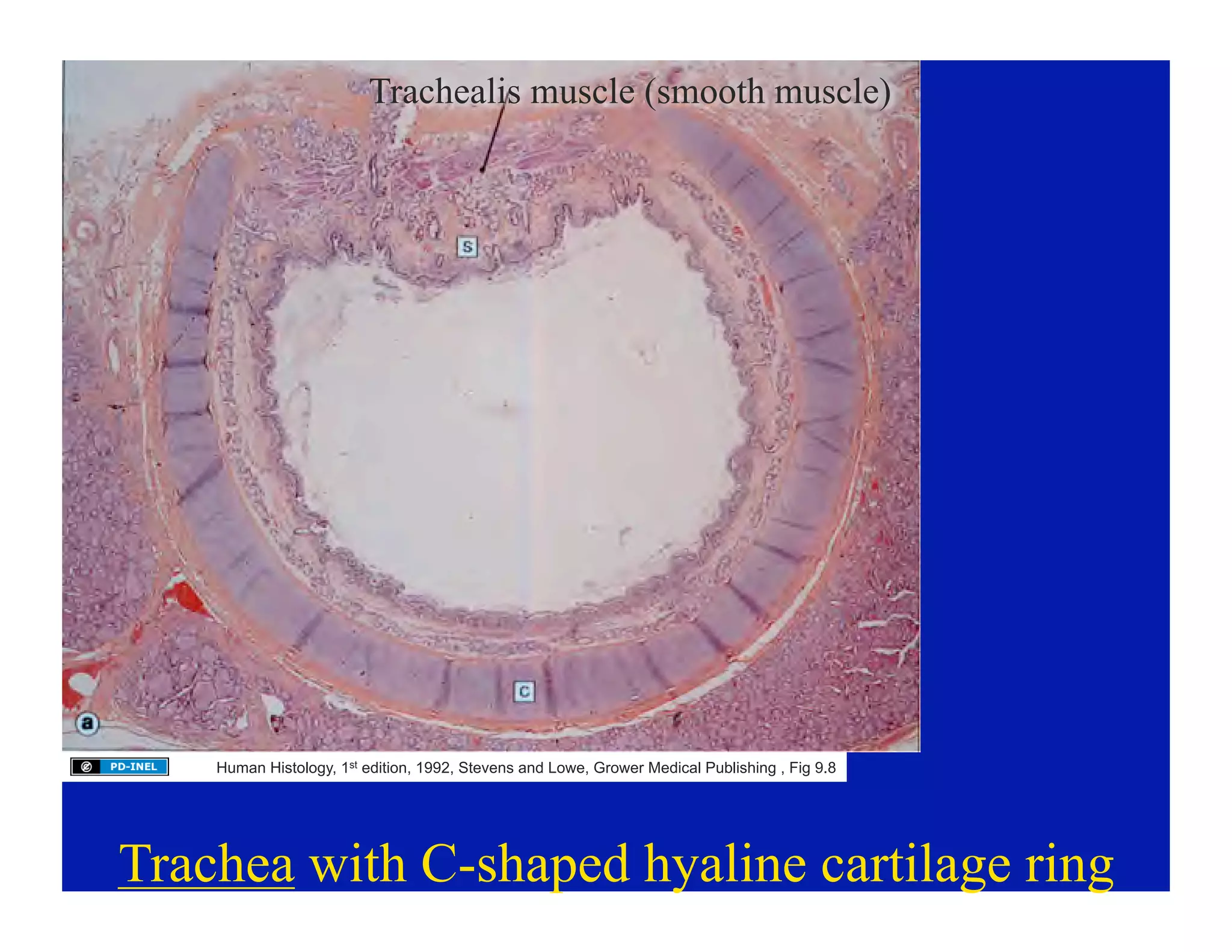11.10.08(d): Histology of the Respiratory Tract | PDF