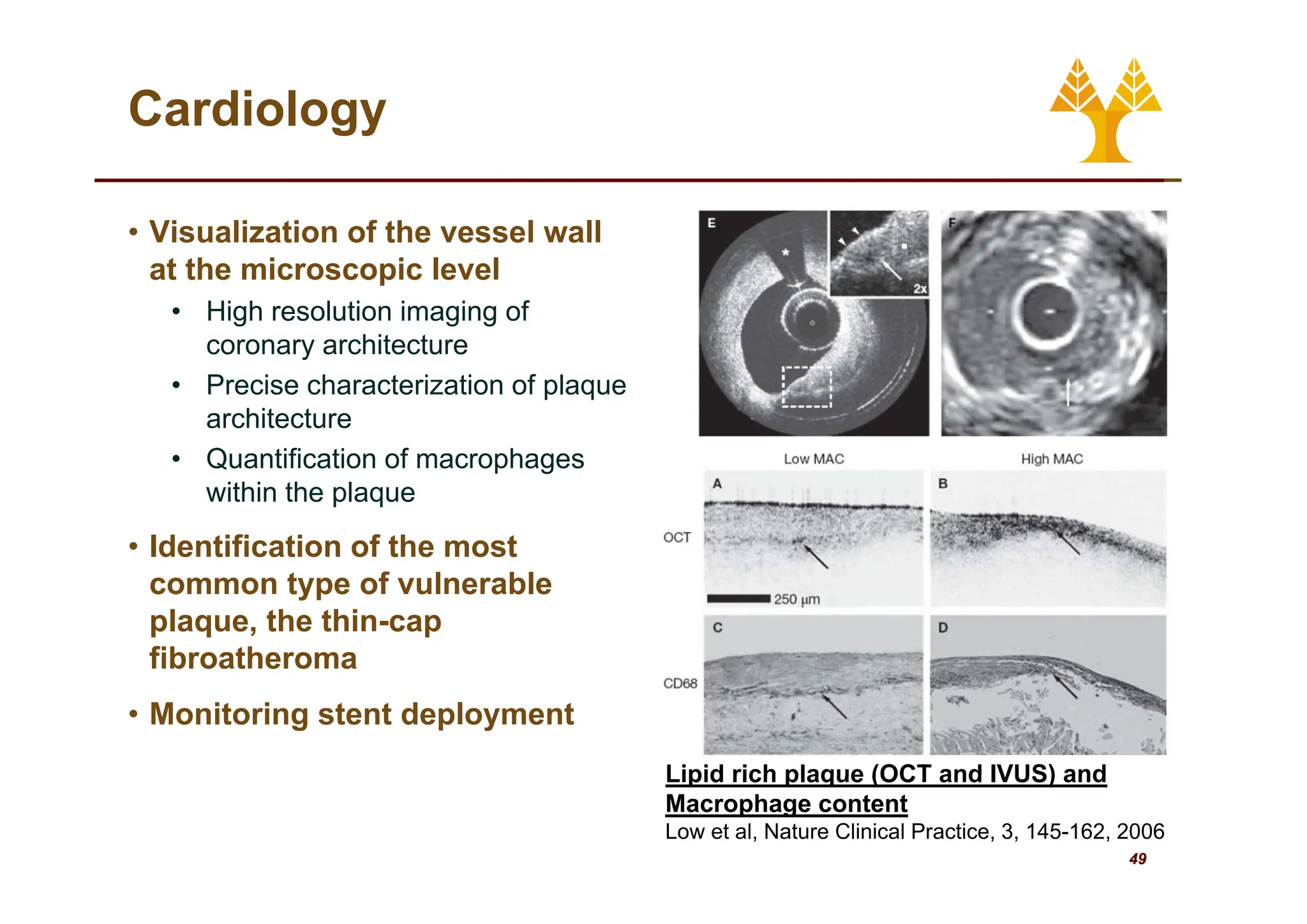 Optical coherence tomography powerpoint presentation | PDF