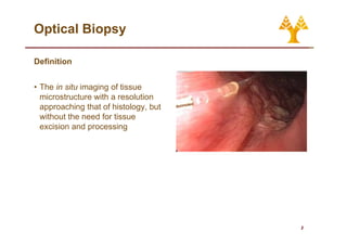 Optical coherence tomography powerpoint presentation | PDF