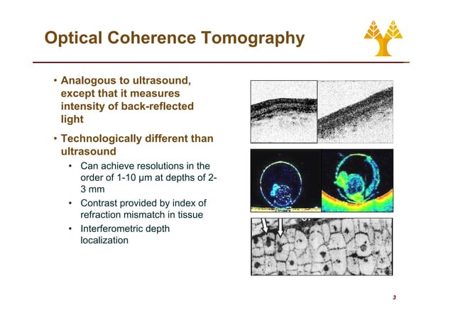 Optical coherence tomography powerpoint presentation | PDF | Physics | Science