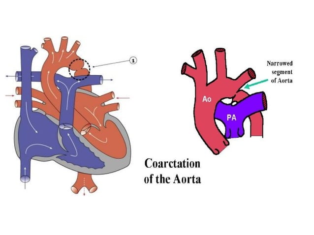 arch of aorta | PPT