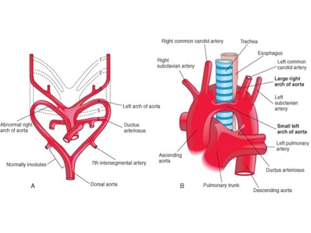 arch of aorta