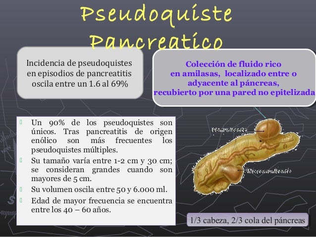Complicaciones qx de pancreatitis