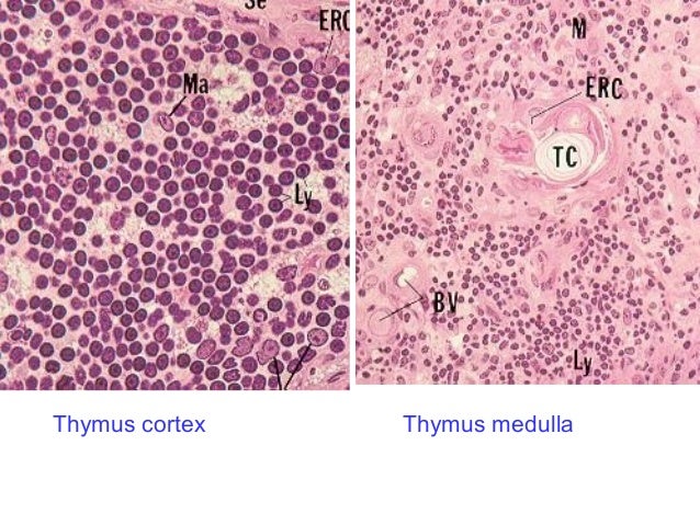 11. lymphoid dol29