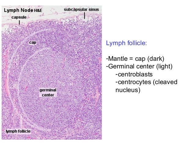 11. lymphoid dol29