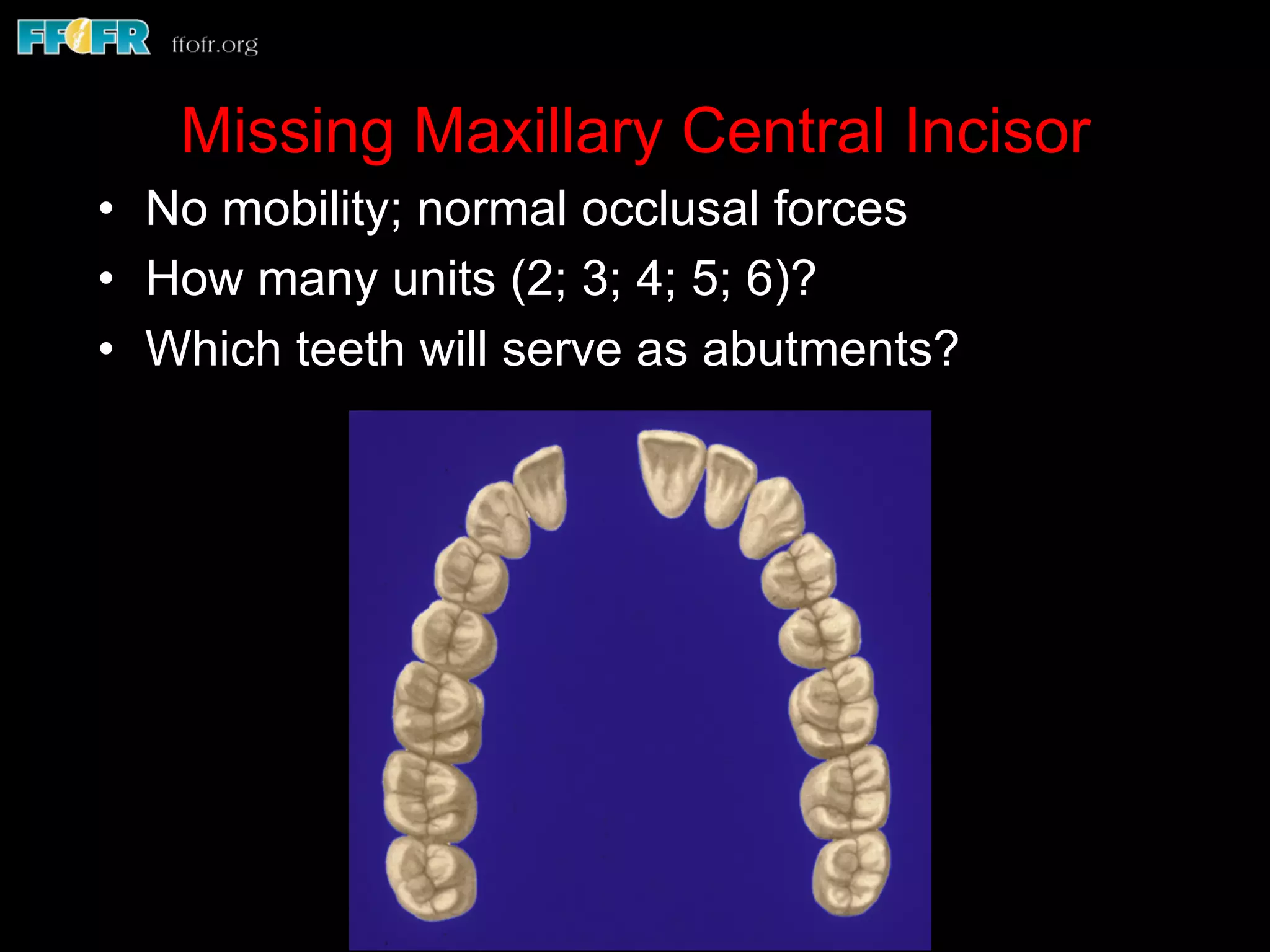 11.tp & fpd designs | PDF