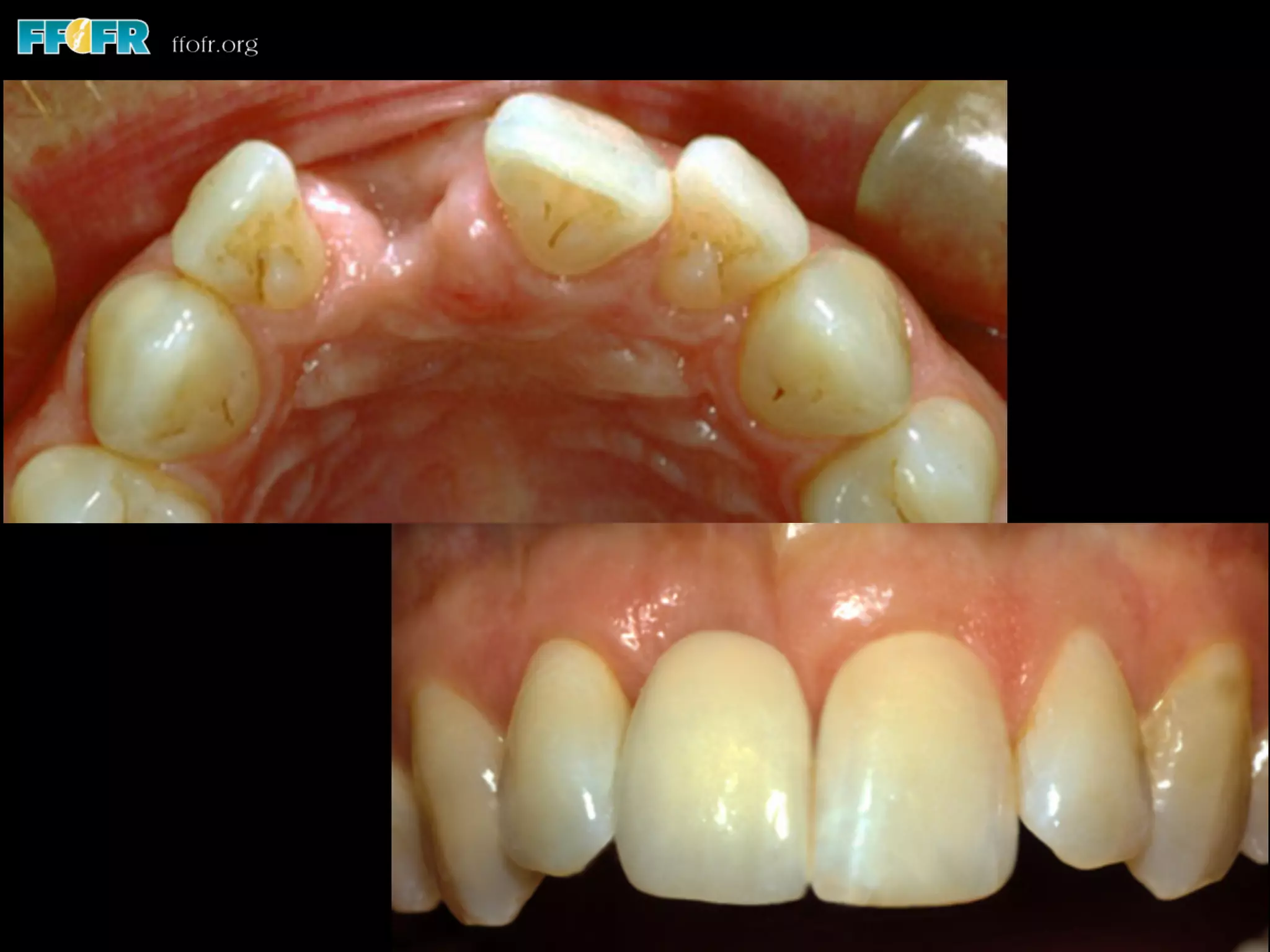 11.tp & fpd designs | PDF