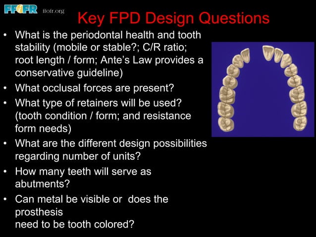 11.tp & fpd designs | PDF | Dental Health | Diseases and Conditions