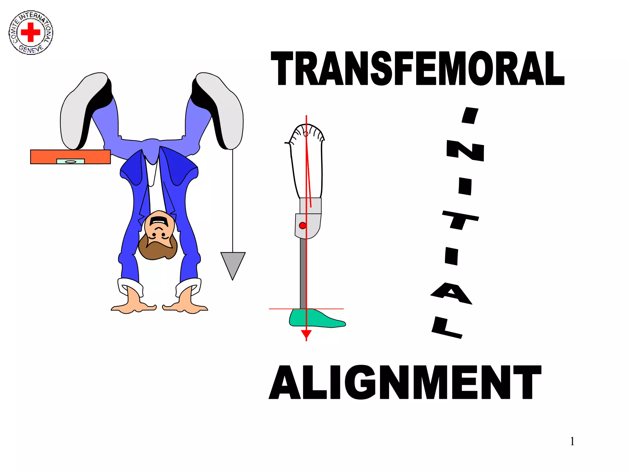 Transfemoral Initial Alignment | PPTX