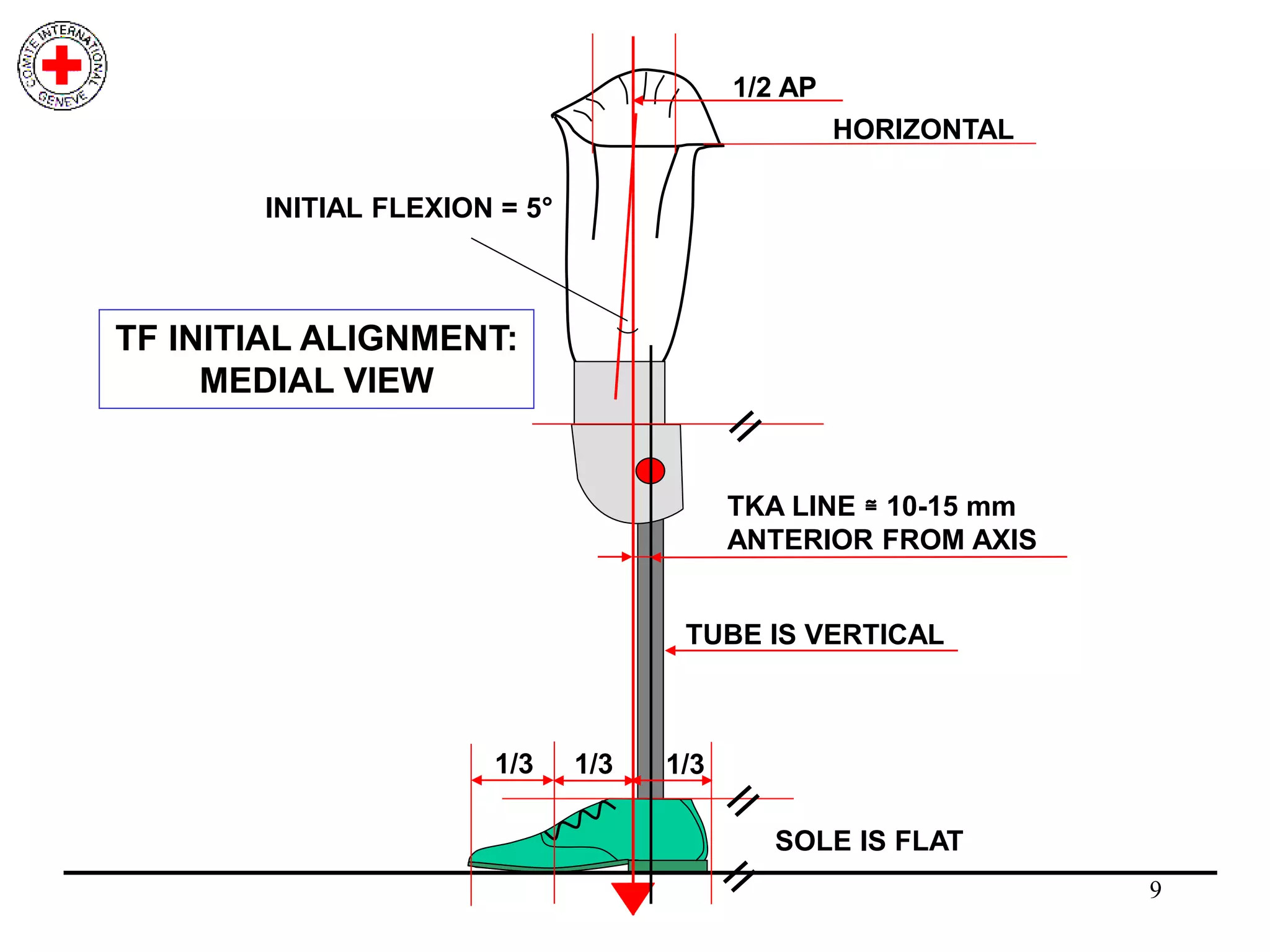 Transfemoral Initial Alignment | PPTX