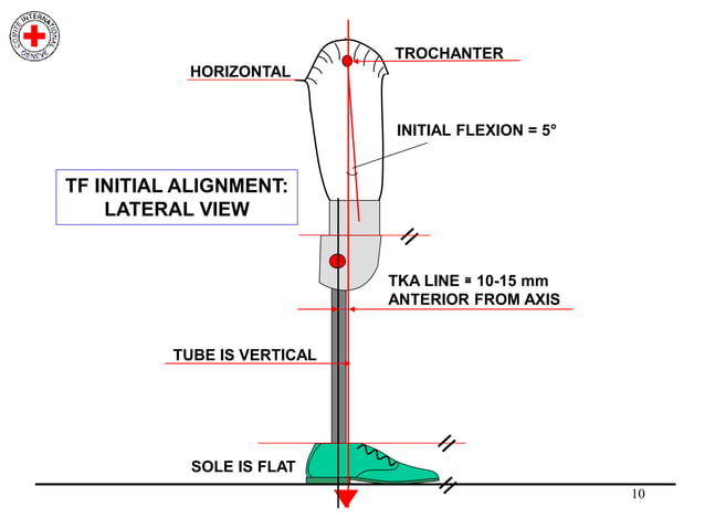 Transfemoral Initial Alignment | PPTX | Death, Injury, or Military ...
