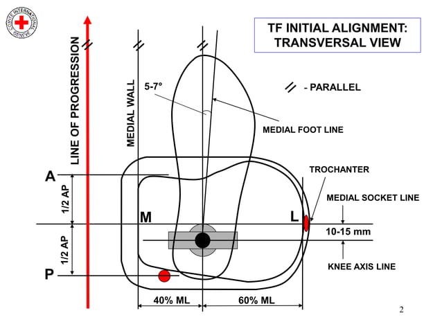 Transfemoral Initial Alignment | PPTX | Death, Injury, or Military ...