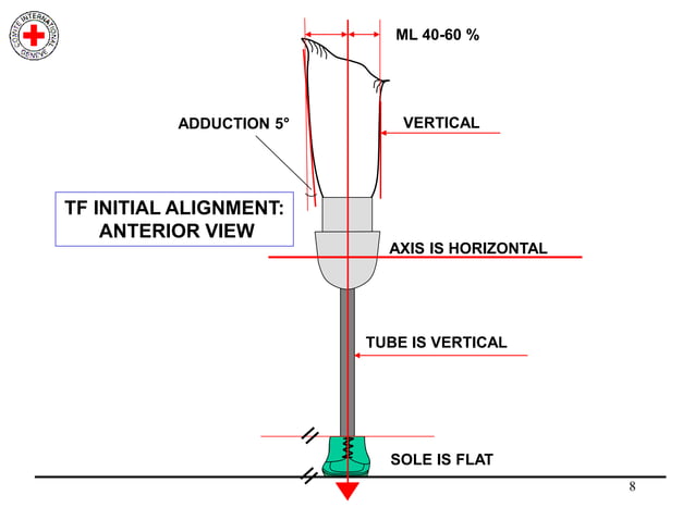 Transfemoral Initial Alignment | PPTX | Death, Injury, or Military ...