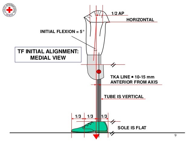 Transfemoral Initial Alignment