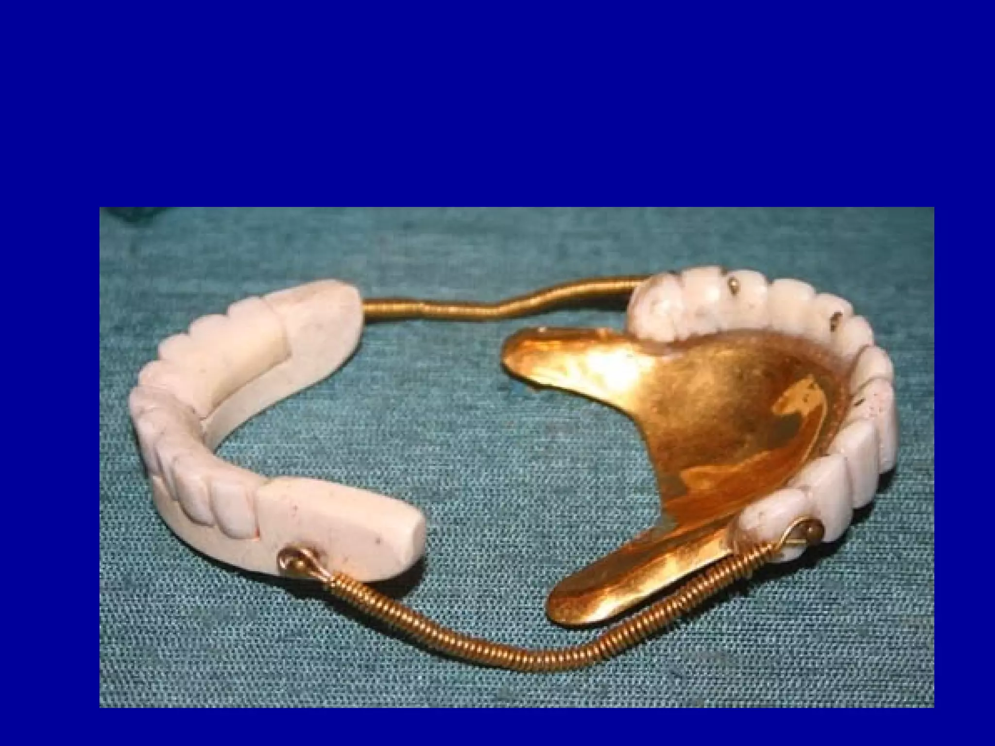 11.complete denture wax‐up and flasking procedure | PPT