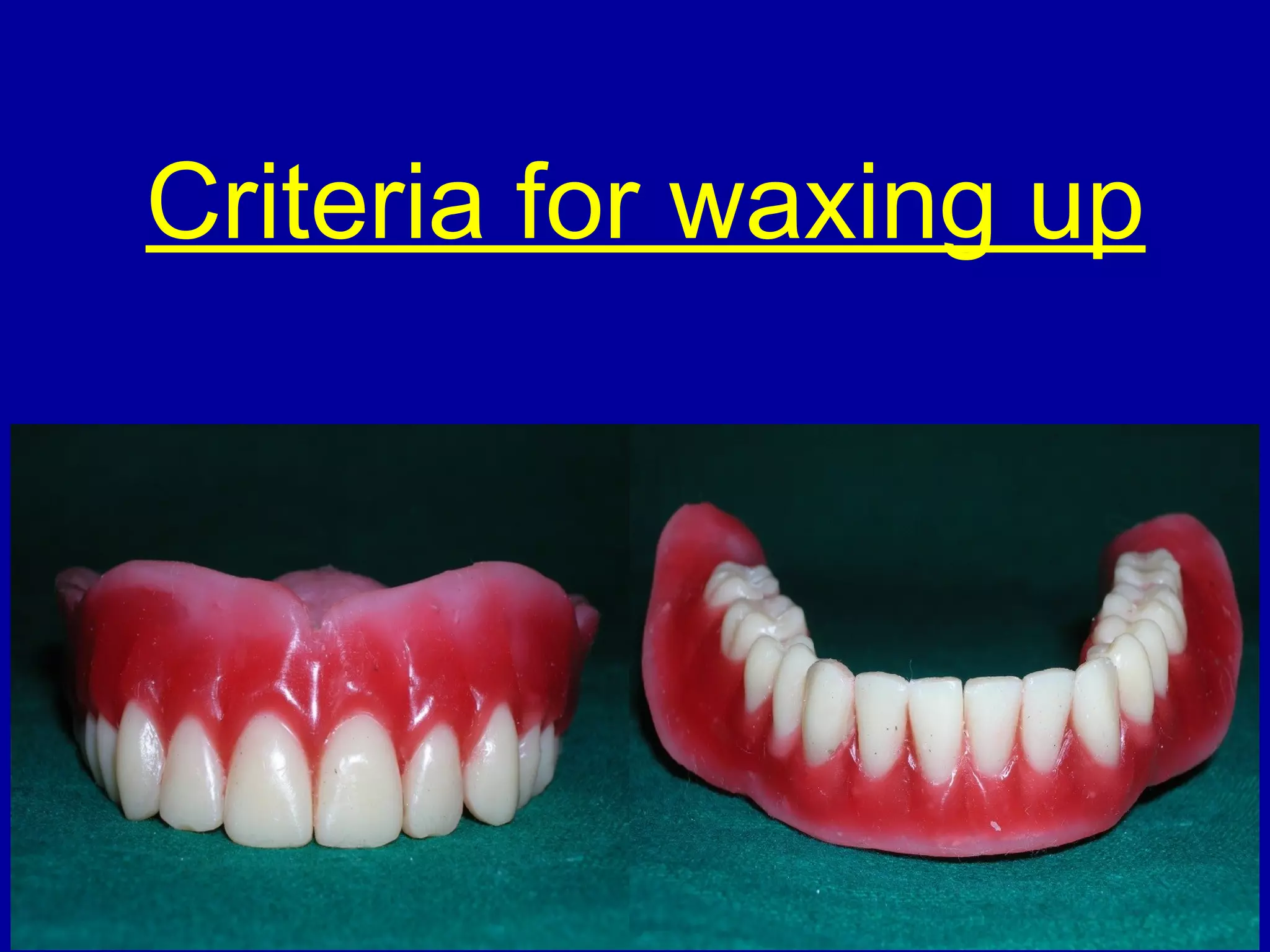 11.complete denture wax‐up and flasking procedure | PPT