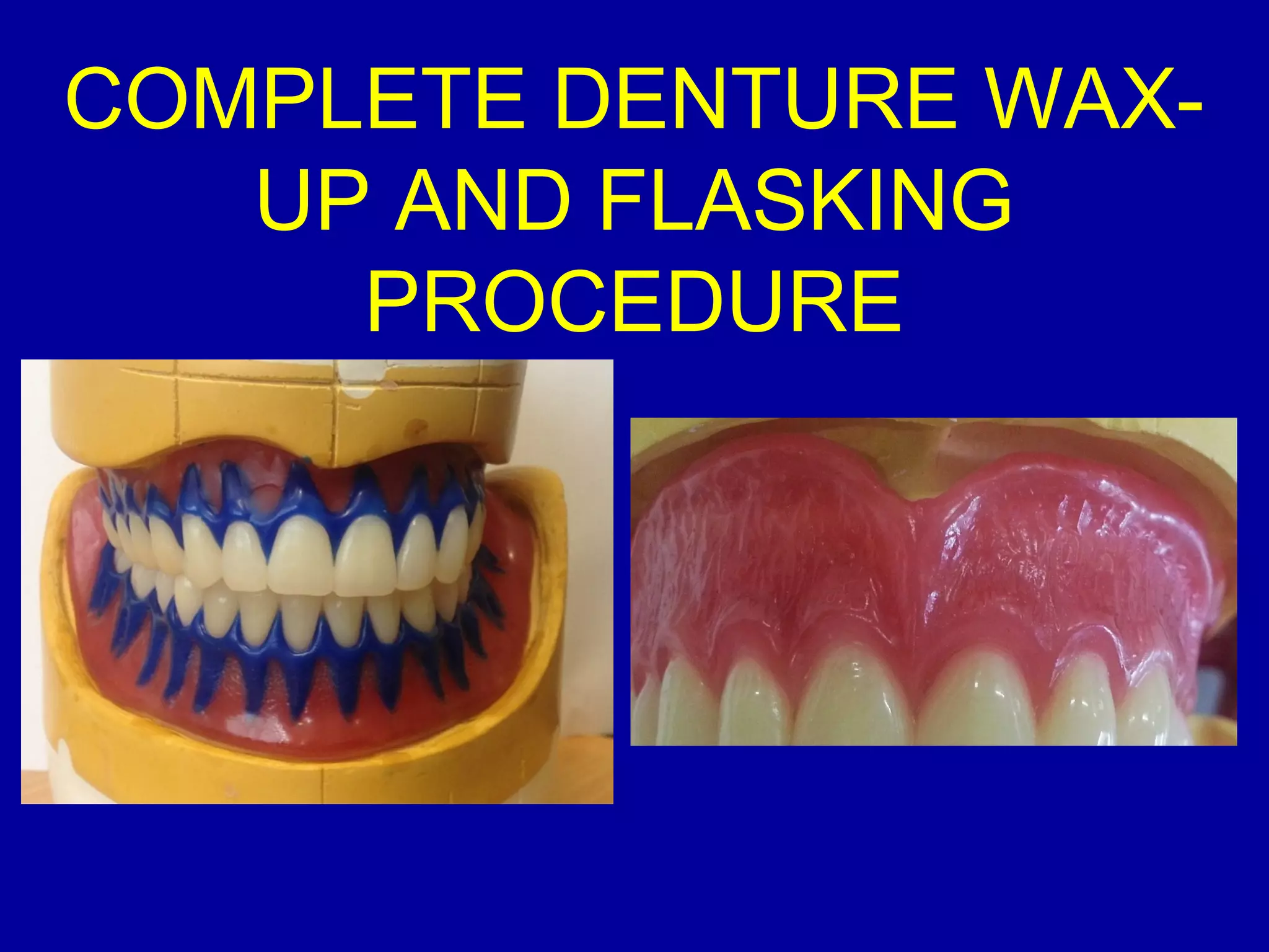 11.complete denture wax‐up and flasking procedure | PPT