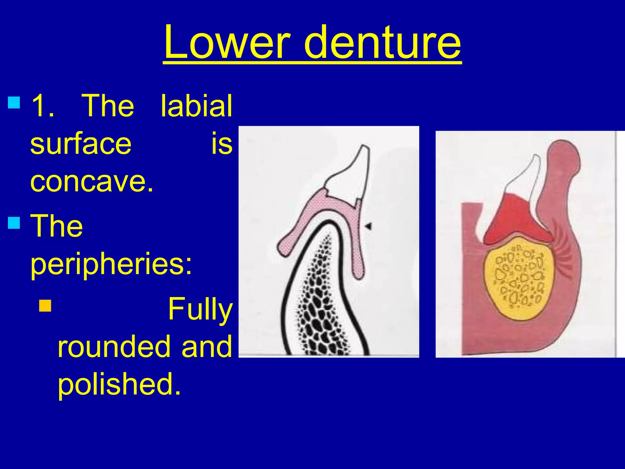 11.complete denture wax‐up and flasking procedure | PPT