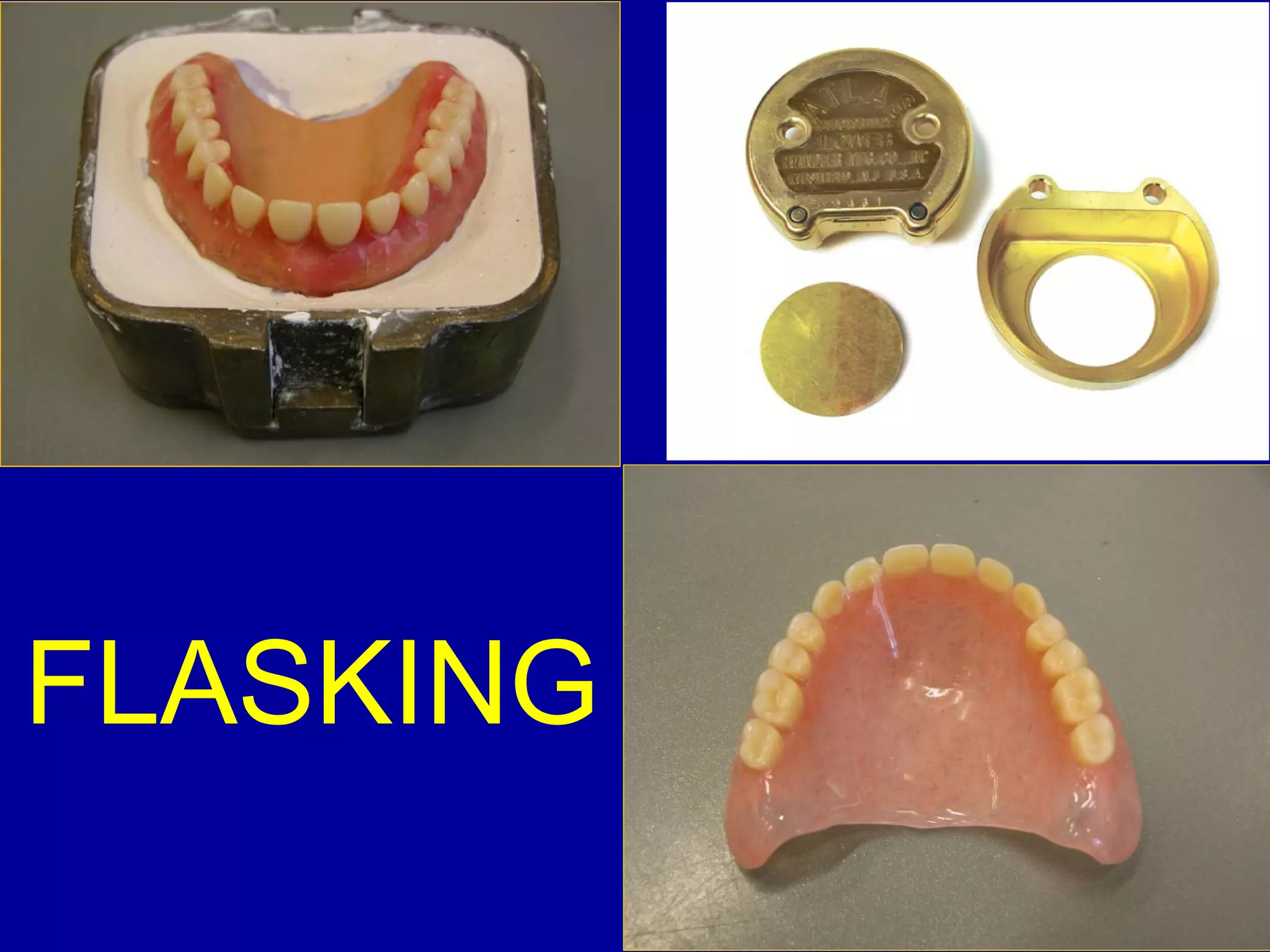 11.complete denture wax‐up and flasking procedure | PPT