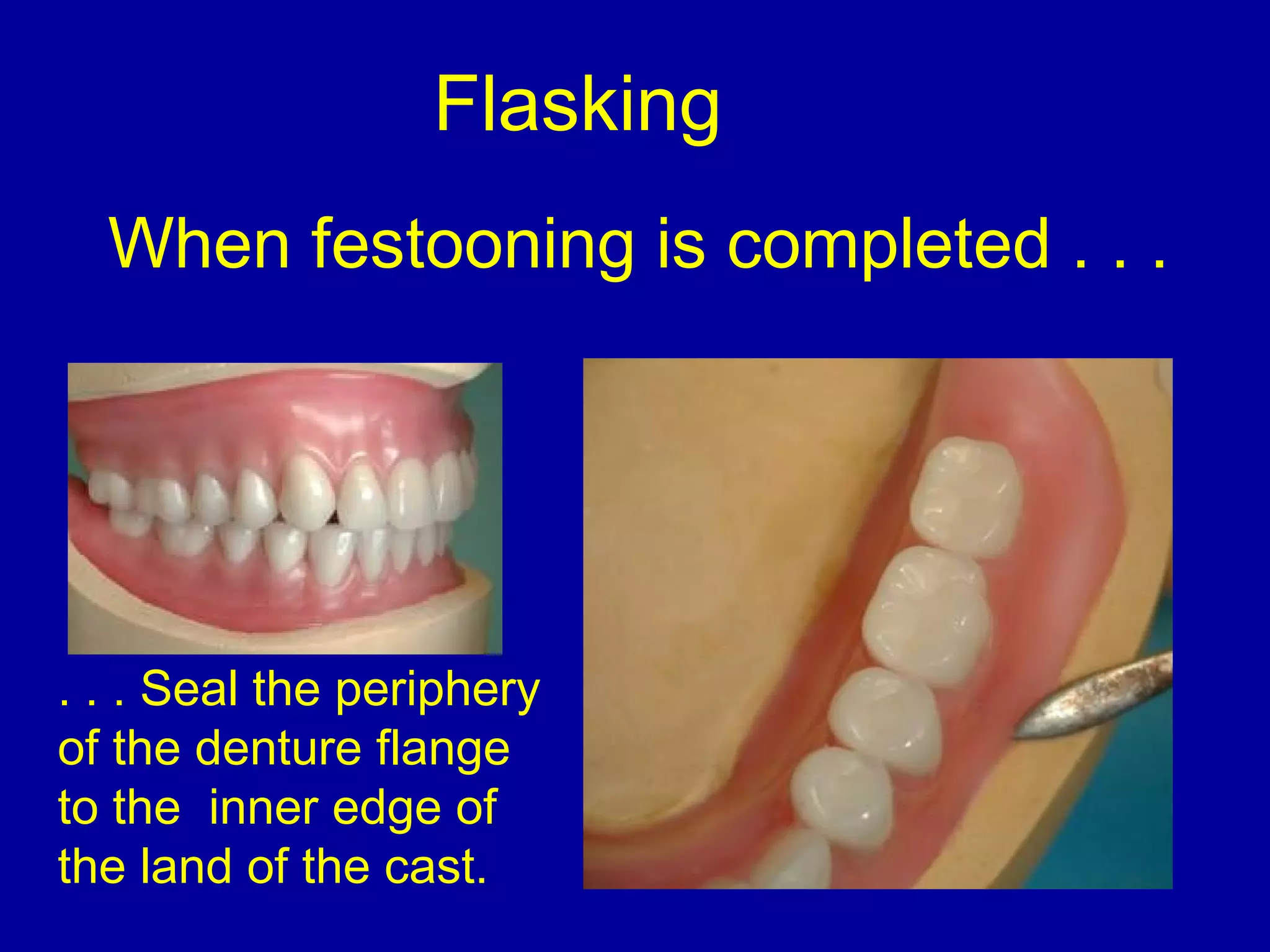 11.complete denture wax‐up and flasking procedure | PPT