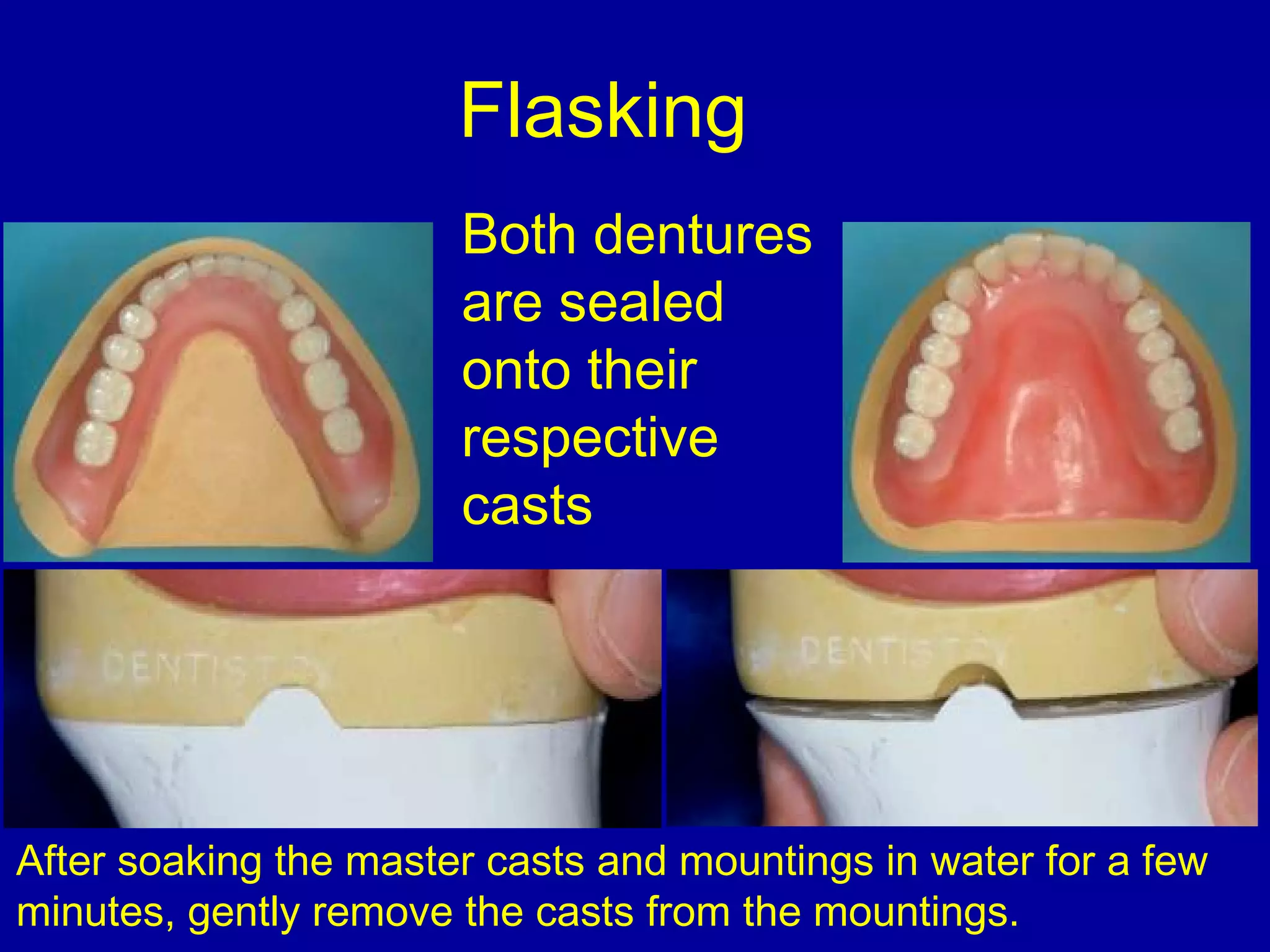 11.complete denture wax‐up and flasking procedure | PPT