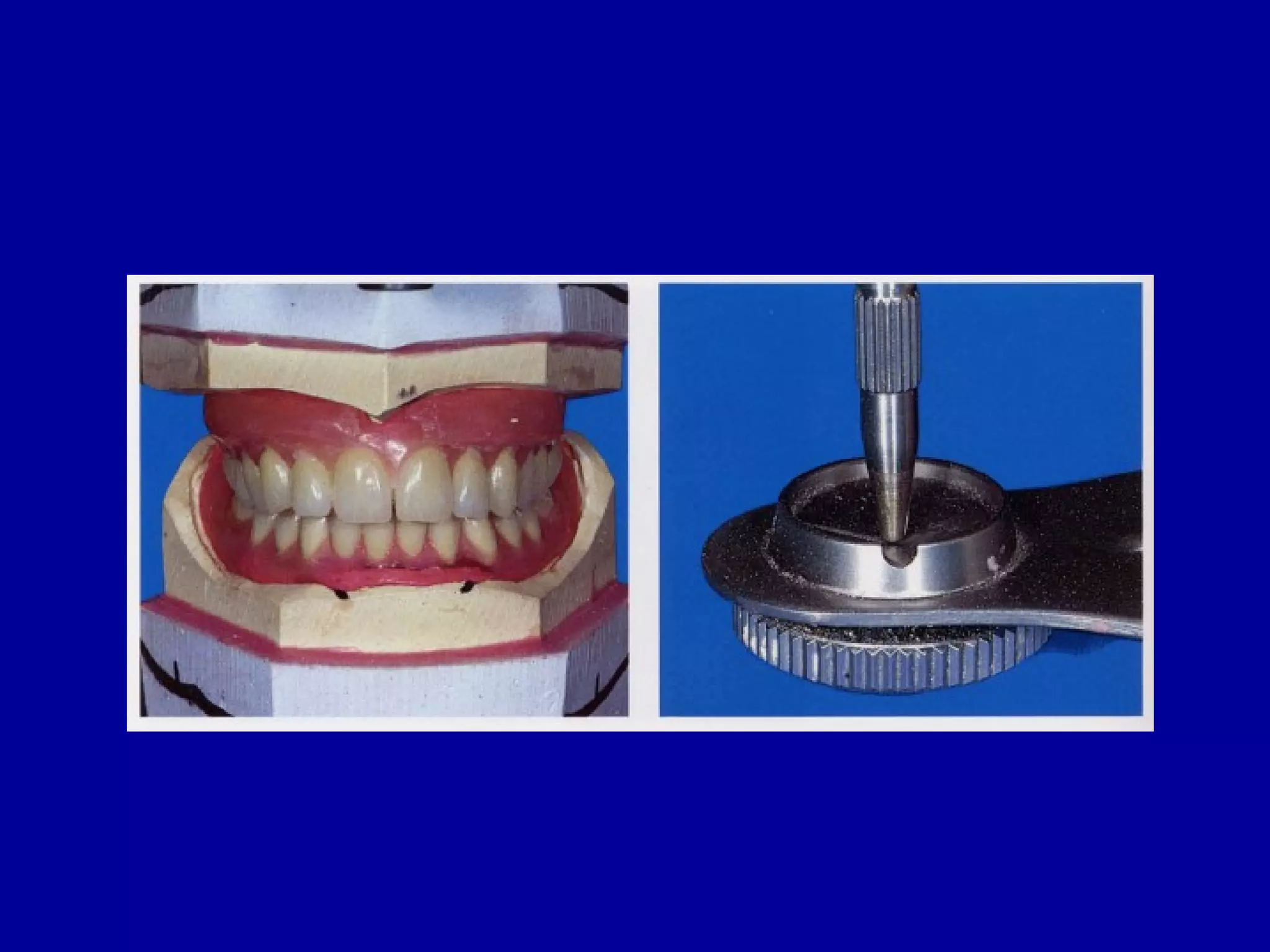 11.complete denture wax‐up and flasking procedure | PPT