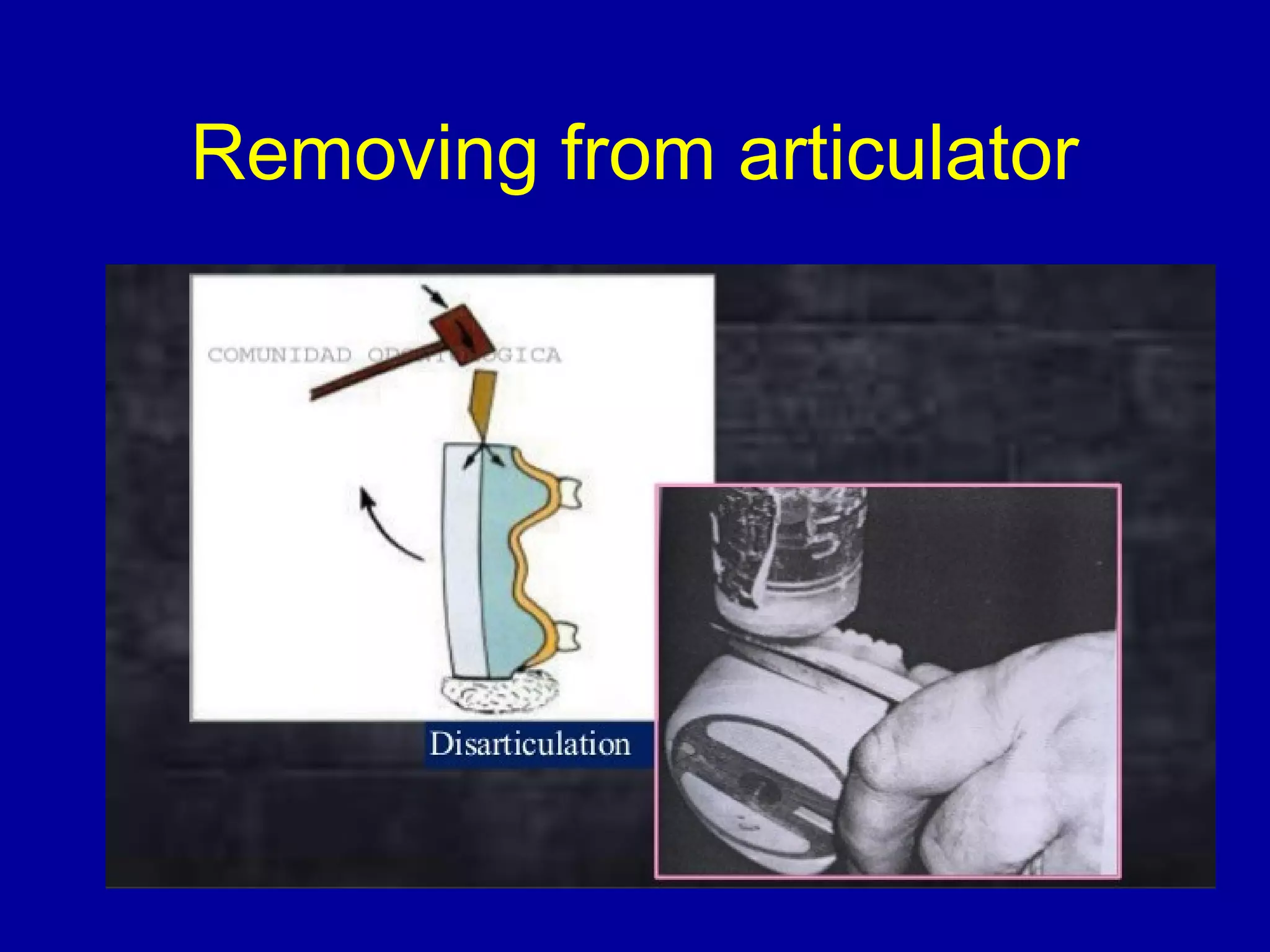 11.complete denture wax‐up and flasking procedure | PPT