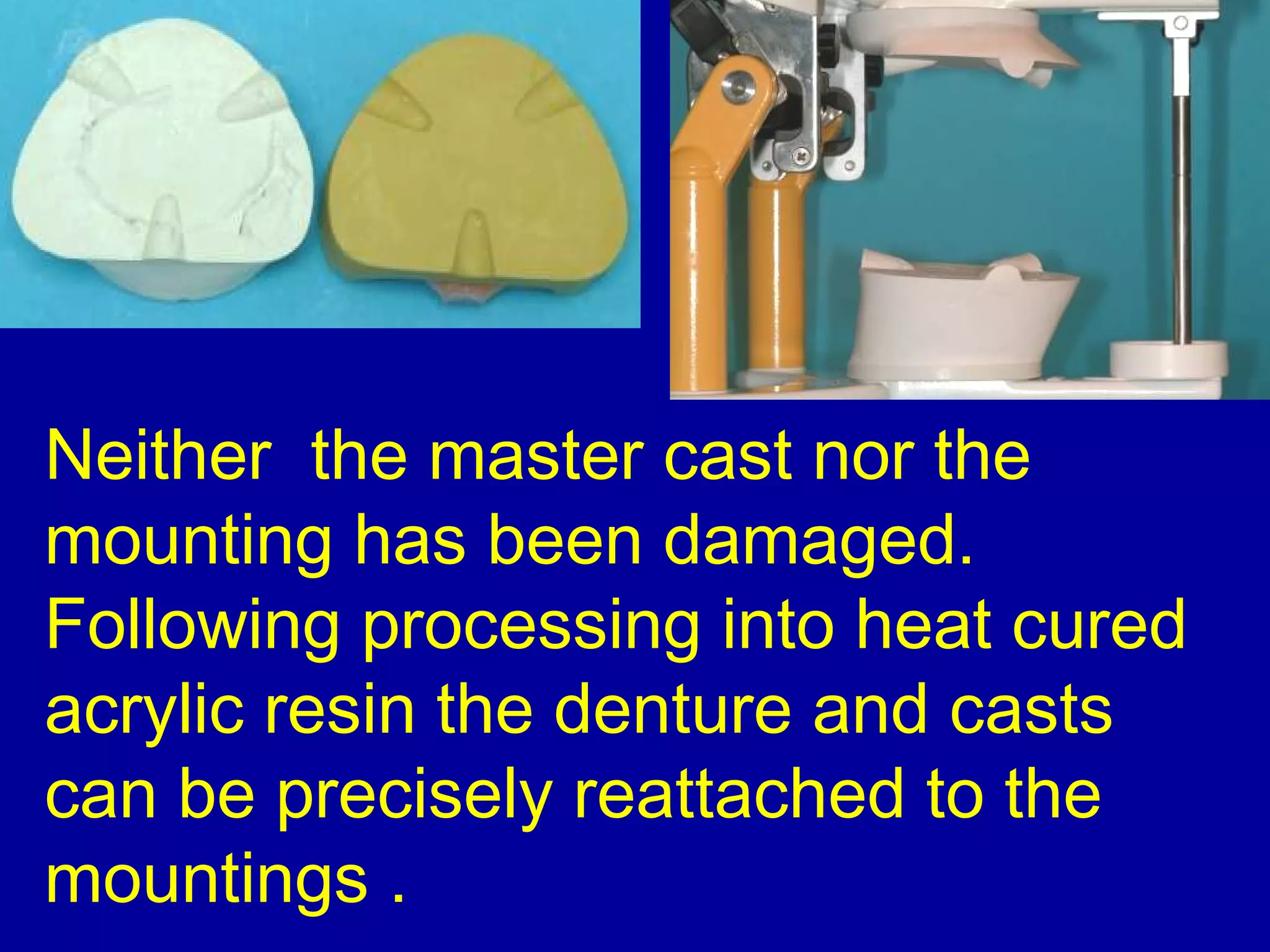 11.complete denture wax‐up and flasking procedure | PPT