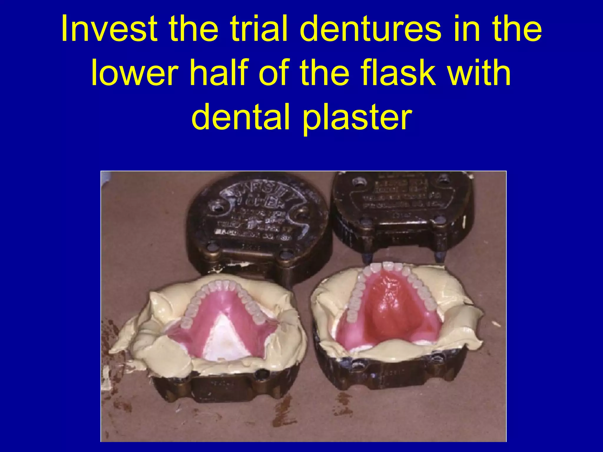 11.complete denture wax‐up and flasking procedure | PPT